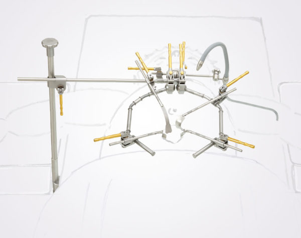 Products General & Vascular Surgery - Condor® MedTec