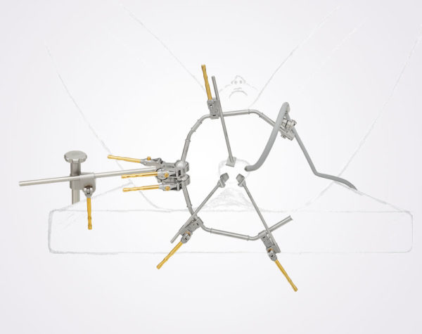 Products General & Vascular Surgery - Condor® MedTec