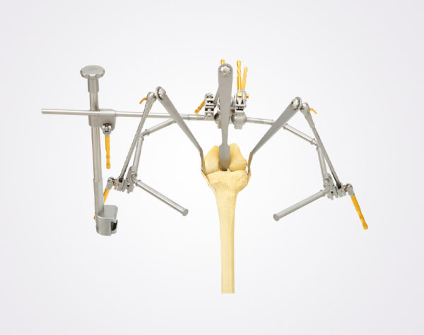 Endoprosthetics Shoulder surgery - Condor® MedTec