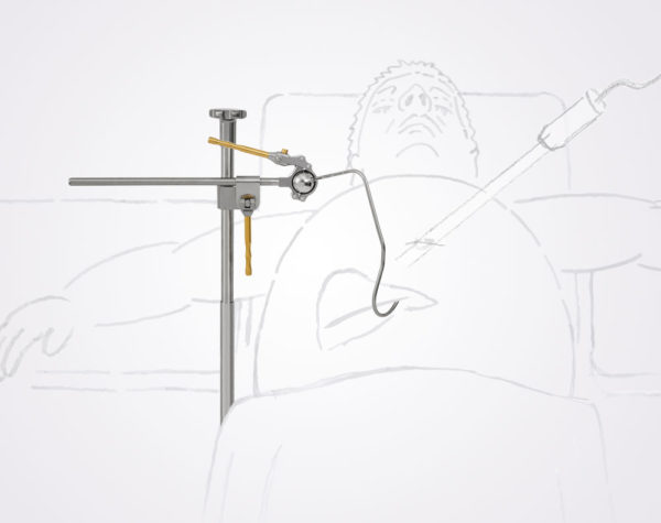 Products Minimally Invasive Surgery - Condor® MedTec