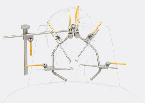 Products General & Vascular Surgery - Condor® MedTec