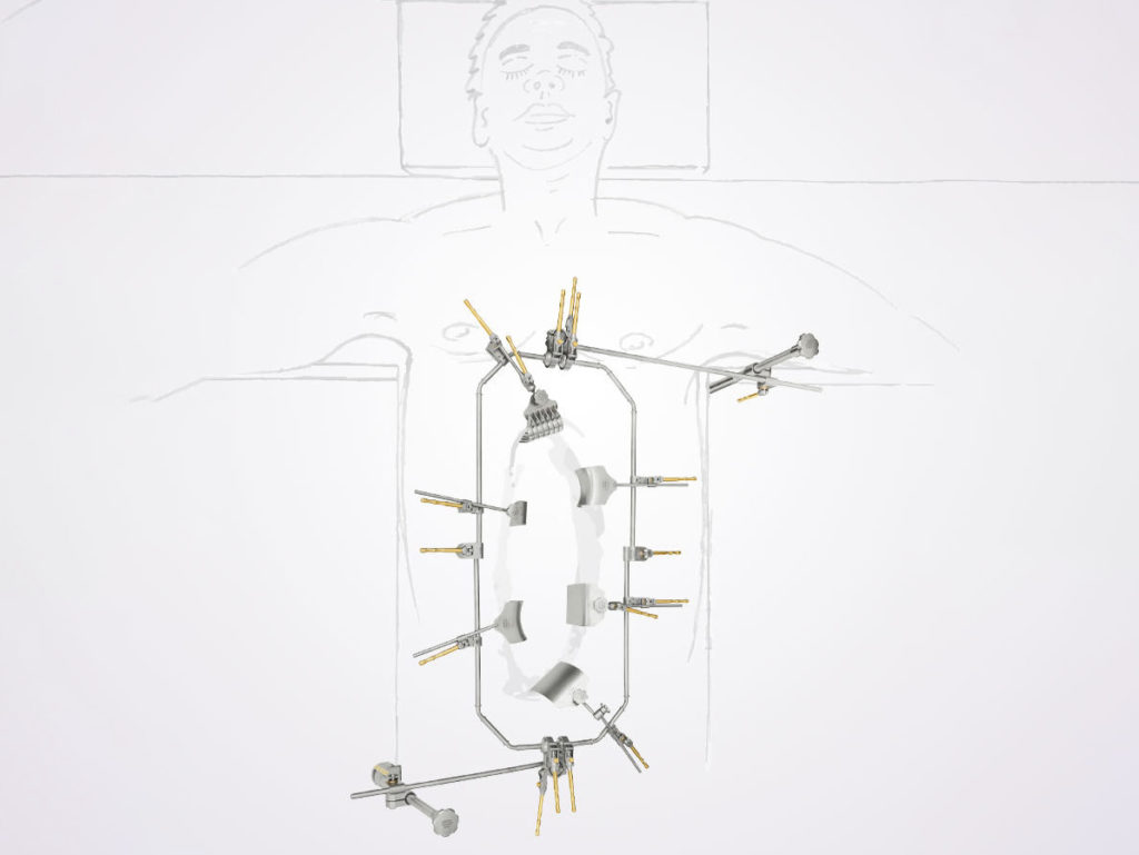 Products General & Vascular Surgery - Condor® MedTec